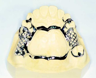 CCP Framework | Global Dental Lab